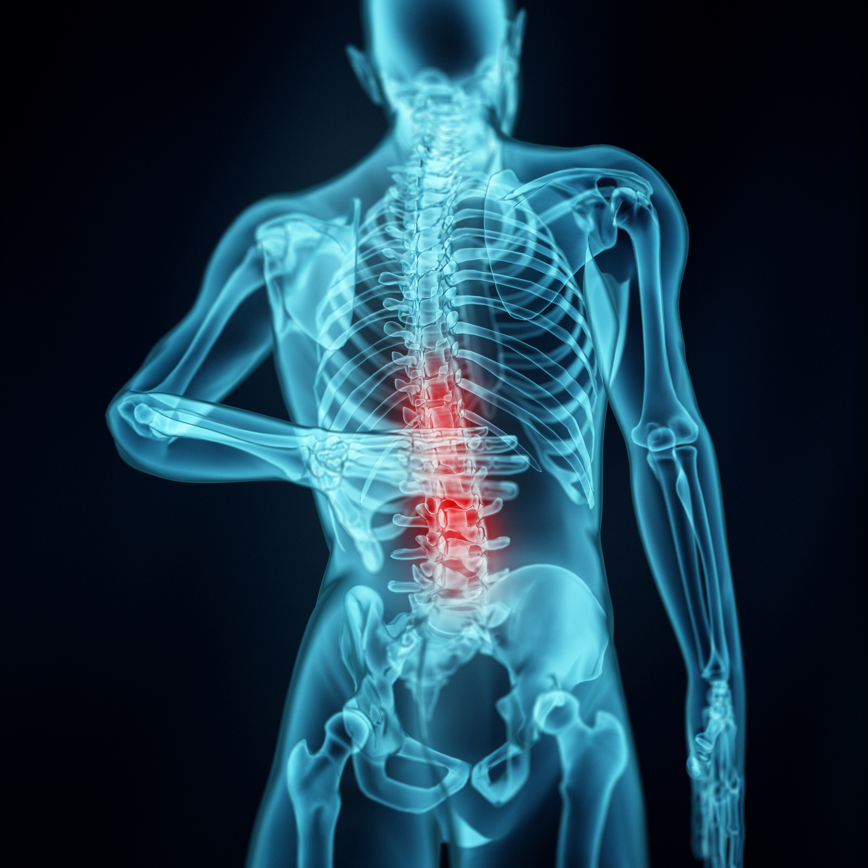 What does a musculoskeletal (MSK) ultrasound tell you that an X-Ray or ...