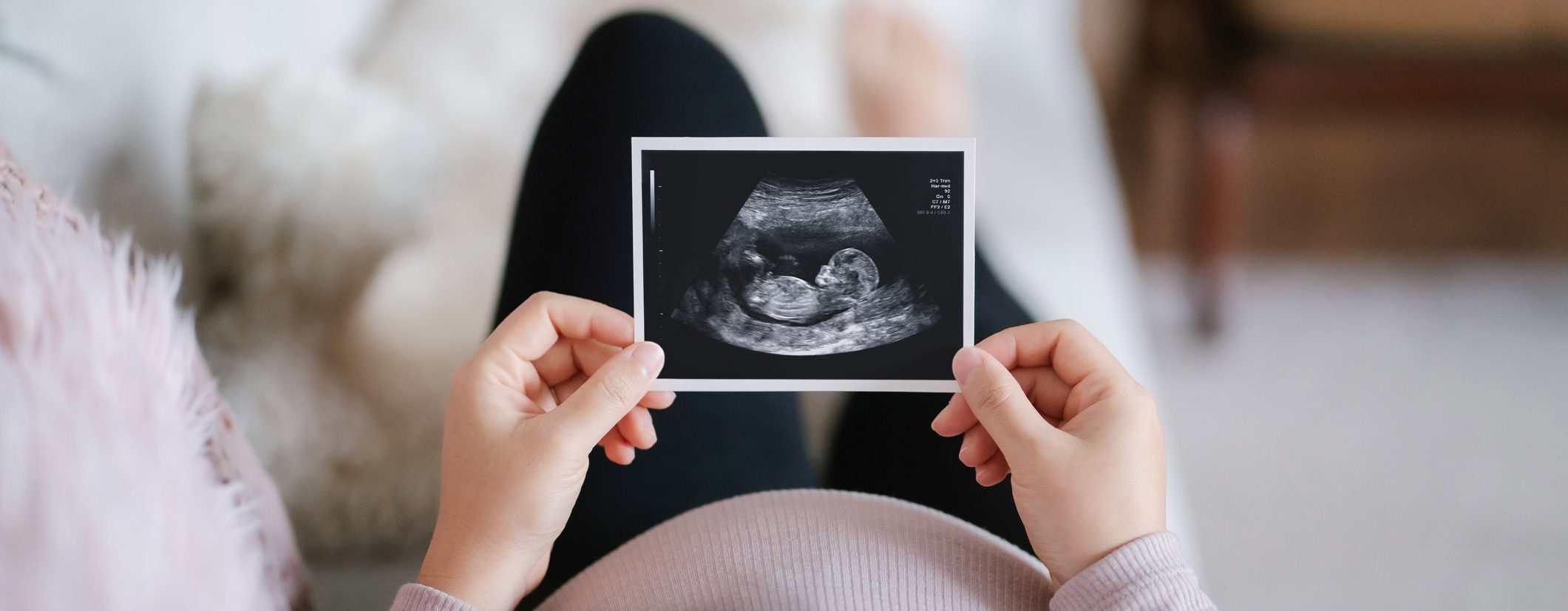 The Detailed Anatomical Ultrasound AKA The Second Trimester Anatomical ...